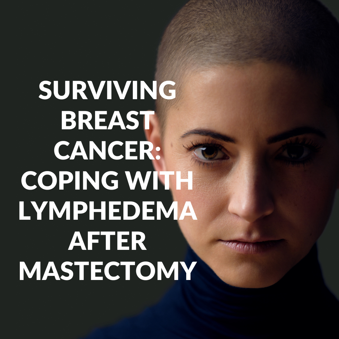 Surviving Breast Cancer: Coping with Lymphedema after Mastectomy ...