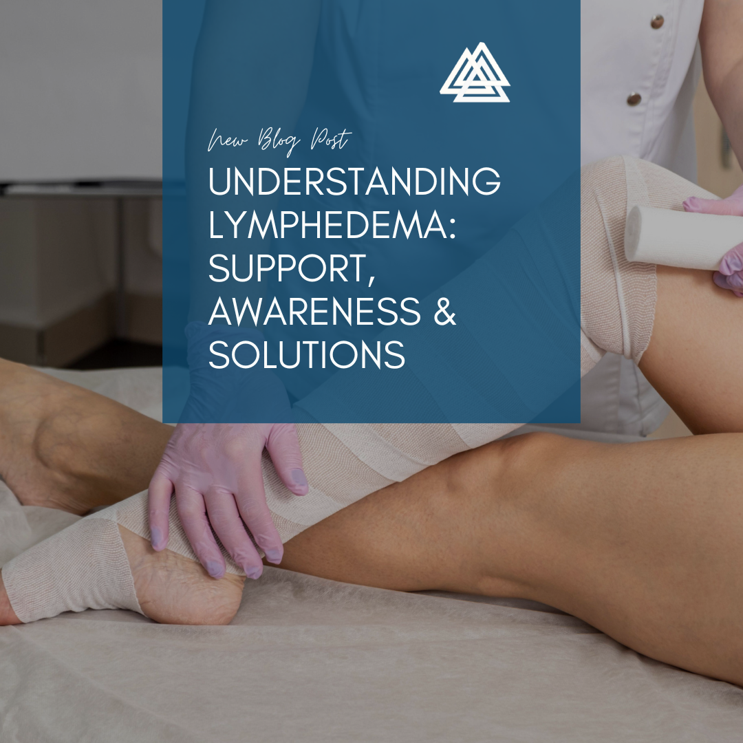 Understanding Lymphedema: Support, Awareness & Solutions A Message from Prism - Prism Dynamic ...